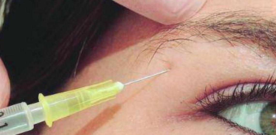 ContextoExato - Não franzo a testa desde 1987, diz médica que descobriu ...